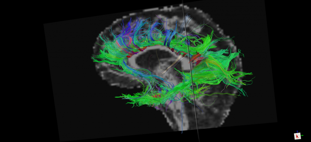 Fiber Tracking | Structural Neuroimaging With OS X